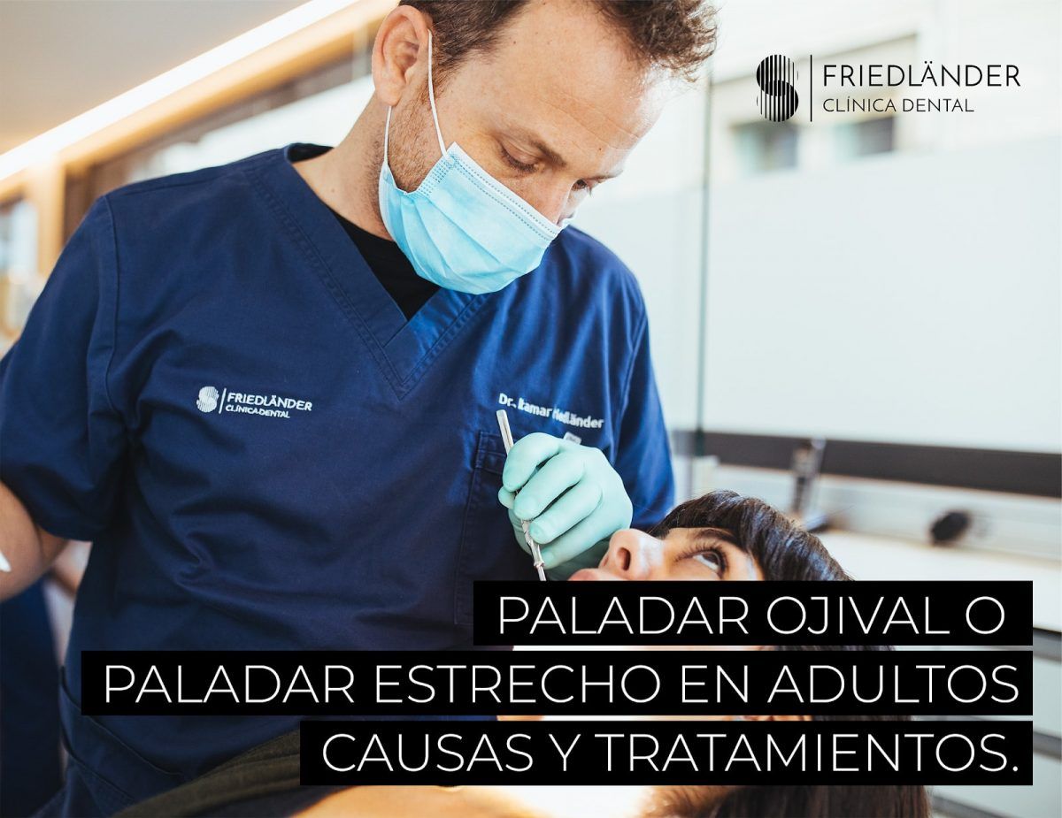 Paladar estrecho en adultos, causas y tratamientos