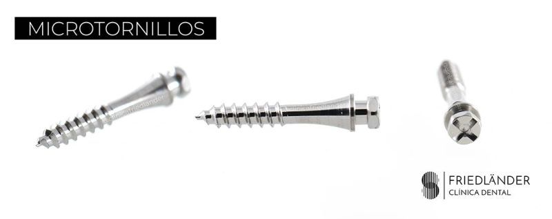 Microtornillos en ortodoncia: ¿Qué es? | Clínica Friedländer