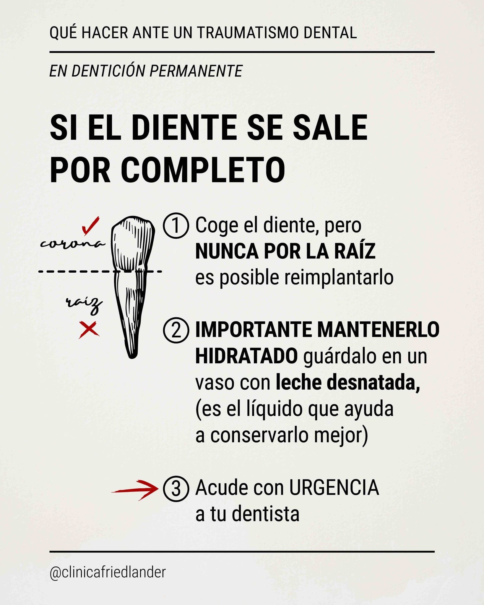 Guía de traumatismo dental: diente roto o fracturado