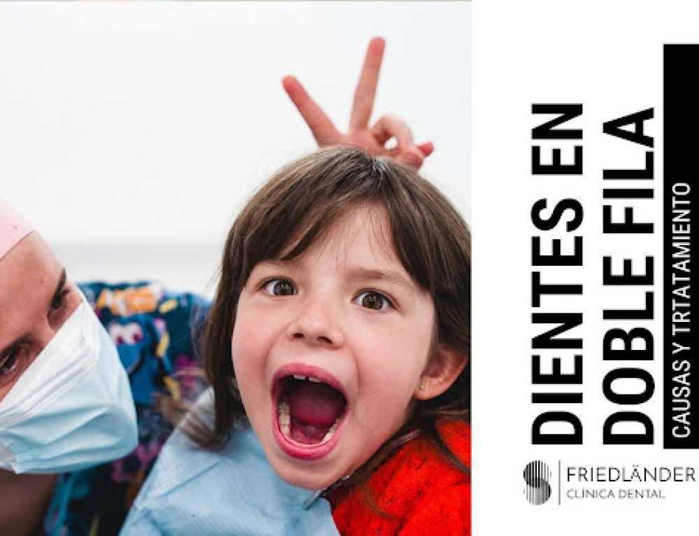 Expansión de paladar estrecho en niños | Clínica Friedlander