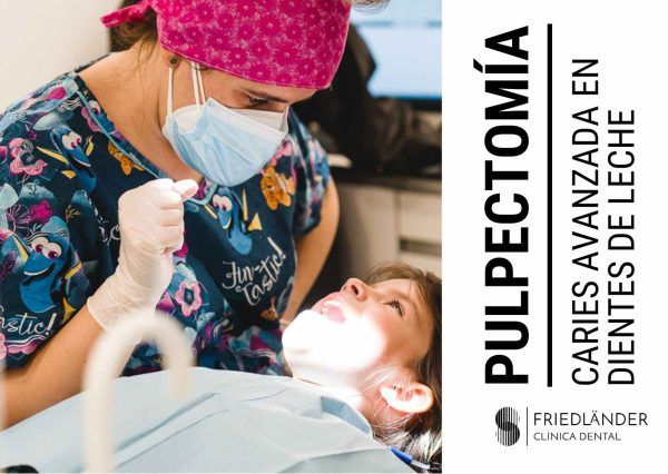 ¿Qué es la pulpectomía? | Clínica Dental Friedländer